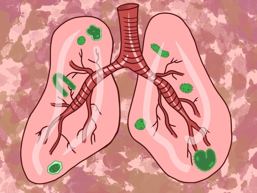 Yale Researchers Discover New Approach To Reversing Lung Scarring Yale Daily News